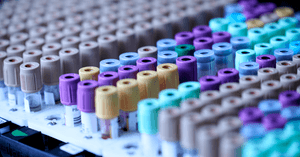 How to Write Good Unit Tests: 14 Tips